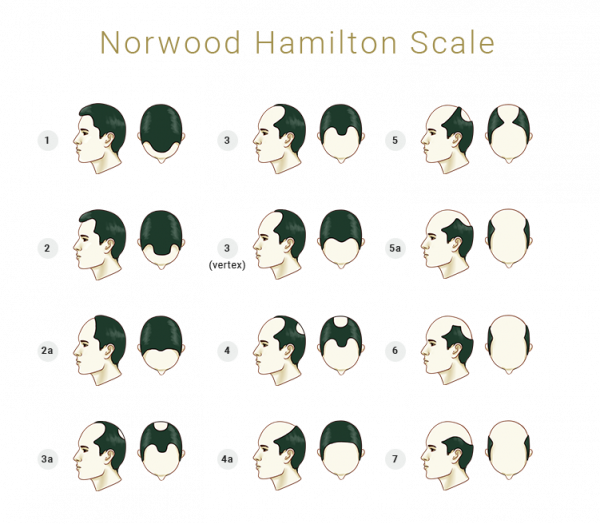 Male Hairloss - Sage Medical